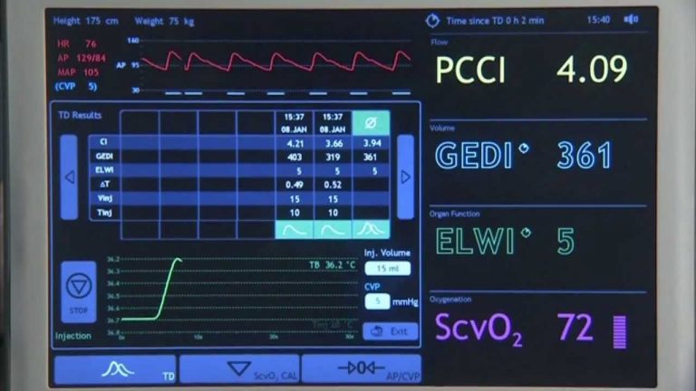 Pulse index Contour Continuous Cardiac Output | Bu sandıklar.. Pulse index Contour Continuous Cardiac Output | Bu sandıklar..
